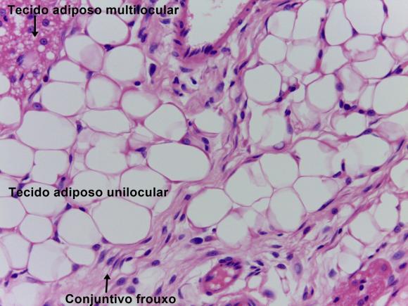 Tecido Adiposo: Tipos e Reserva de Energia - Biomedicina Online