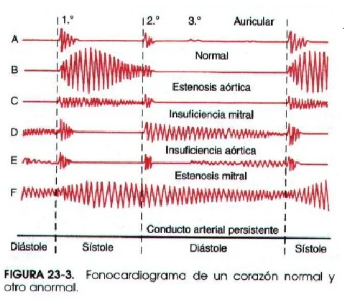 Bulhas Cardíacas: Como Interpretar uma Ausculta Cardíaca - Biomedicina ...